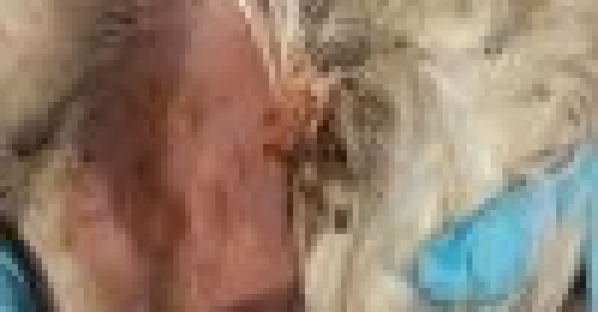 Дундговь аймагт хонины цэцэг өвчин дахин илэрчээ · Dorgio.mn