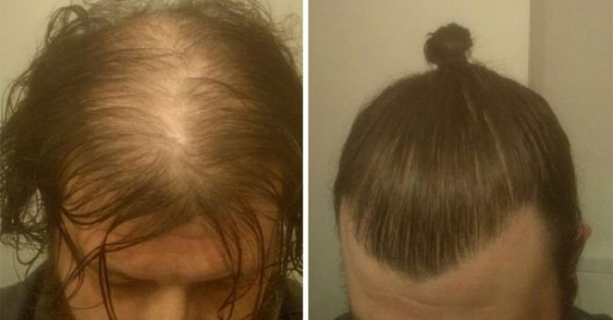 Халзарч байгаа бол үсээ ургуул · Dorgio.mn