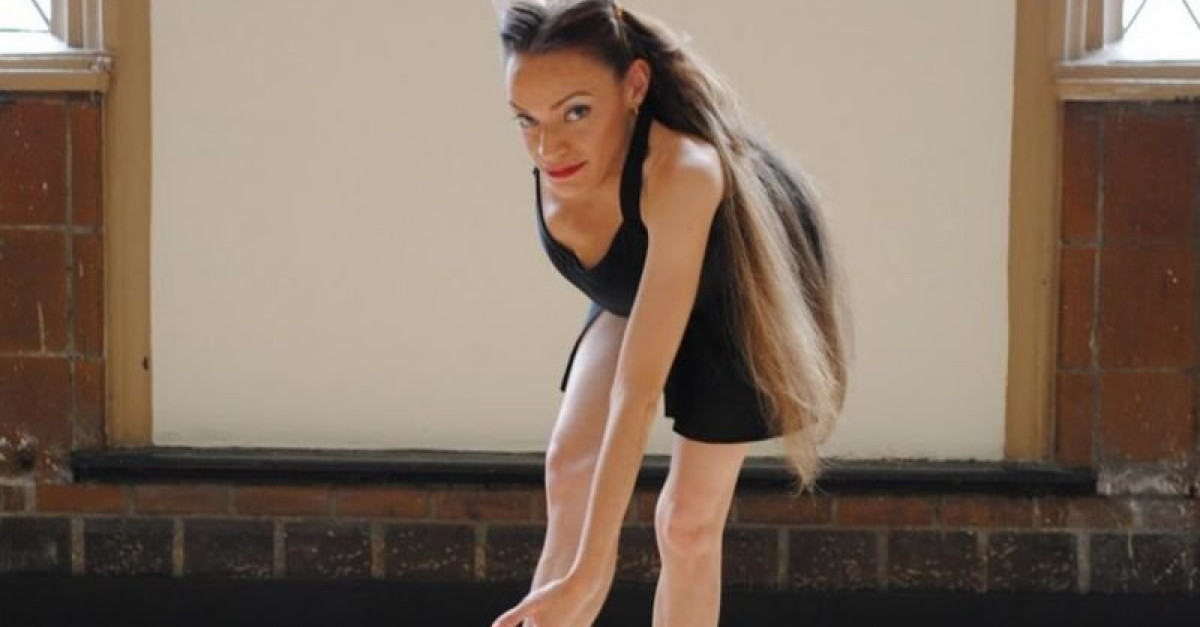 Ясны өвчтэй ч мэргэжлийн бүжигчин болсон бүсгүй · Dorgio.mn