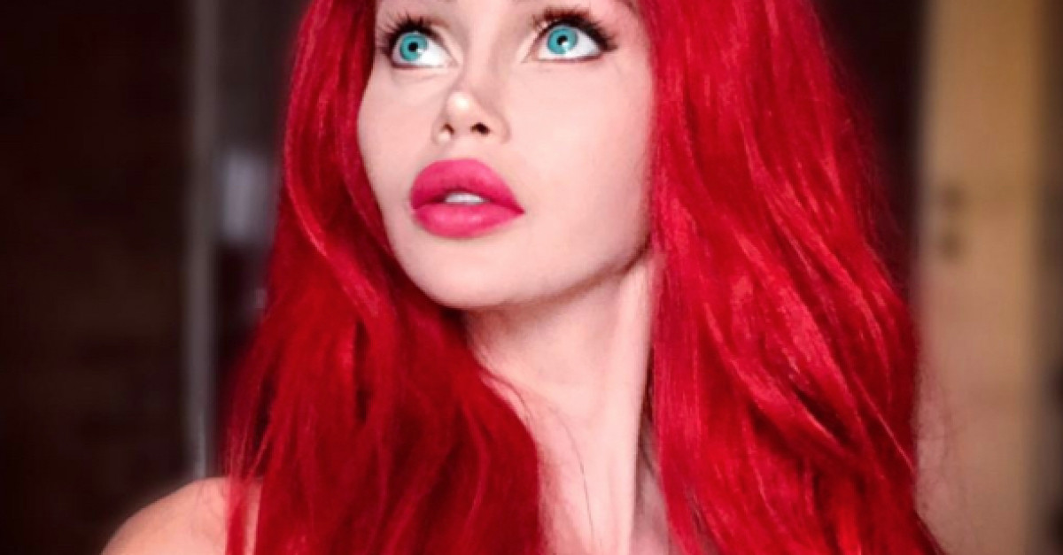 Хүүхэлдэйн киноны баатар шиг болохын төлөө 200 хагалгаанд оржээ · Dorgio.mn