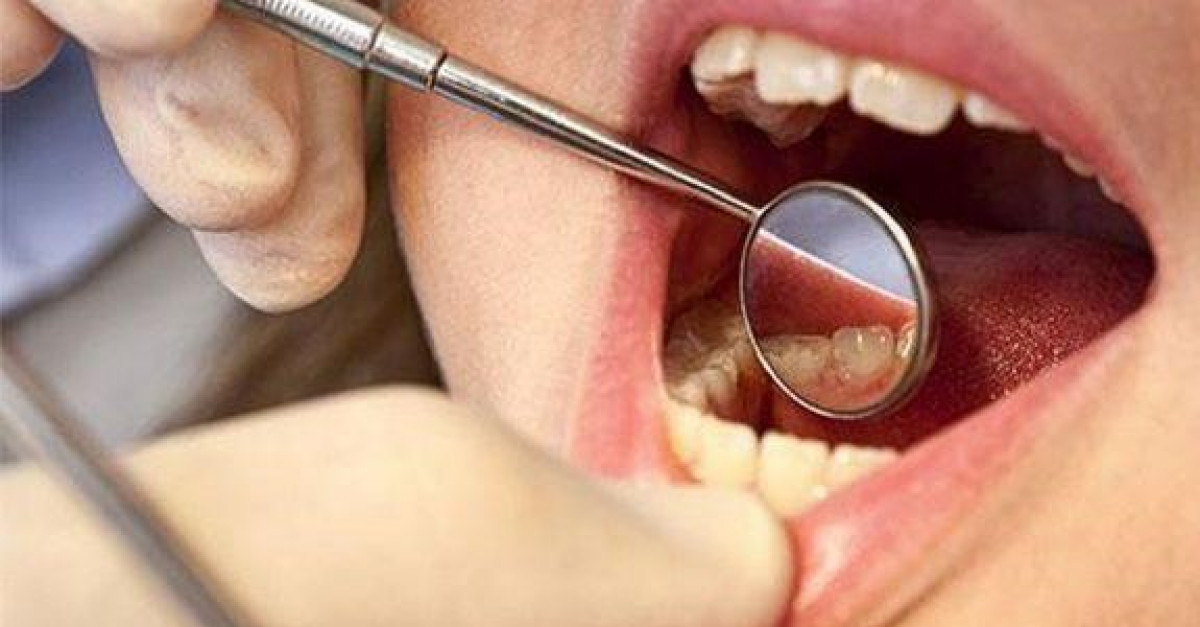 Эрт илрүүлэгт хамрагдсан нэгдүгээр ангийн сурагчдын 83 хувь нь шүдний өвчлөлтэй байна · Dorgio.mn