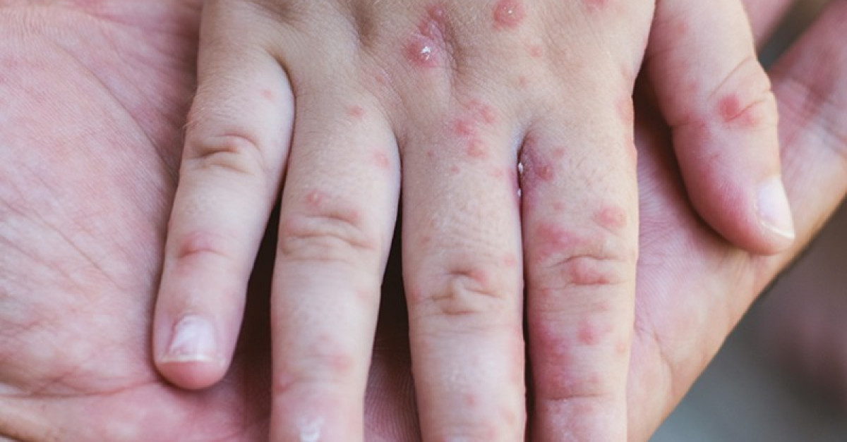 Улаанбурханы батлагдсан тохиолдол 955 боллоо · Dorgio.mn